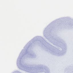 25 - AREA 25 OF INFRALIMBIC PREFRONTAL CORTEX - BrainMaps.org ...