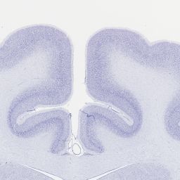 25 - AREA 25 OF INFRALIMBIC PREFRONTAL CORTEX - BrainMaps.org ...