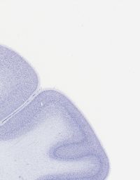 25 - AREA 25 OF INFRALIMBIC PREFRONTAL CORTEX - BrainMaps.org ...