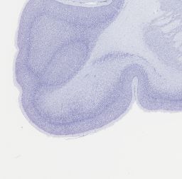 25 - AREA 25 OF INFRALIMBIC PREFRONTAL CORTEX - BrainMaps.org ...