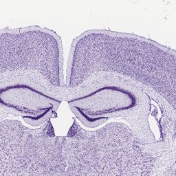 AM - AMYGDALA - BrainMaps.org - Interactive Brain Atlas, Neuroanatomy ...