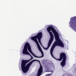 BrainMaps.org - Interactive Brain Atlas, Neuroanatomy, Brain Mapping
