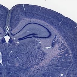 BLA - AMYGDALAE BASOLATERALIS ANTERIOR - BrainMaps.org - Interactive ...
